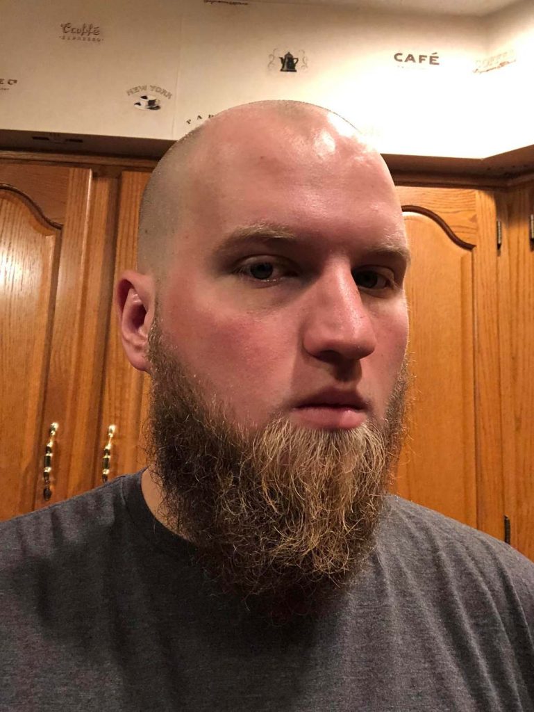 15 Beard Without Mustache Styles for Men | Fashionterest